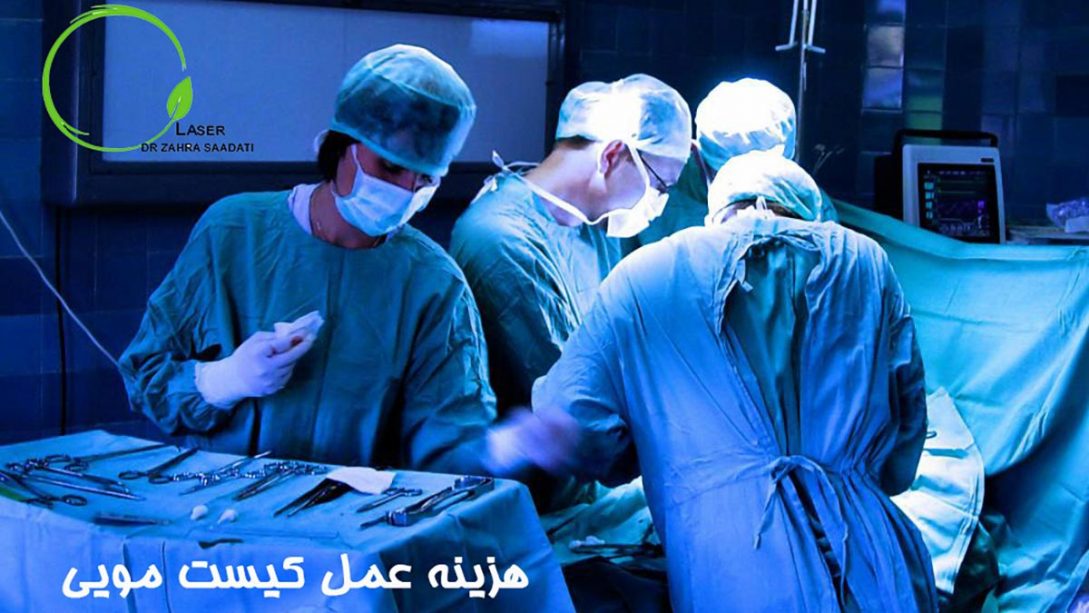 هزینه عمل کیست مویی دکتر زهرا سعادتی